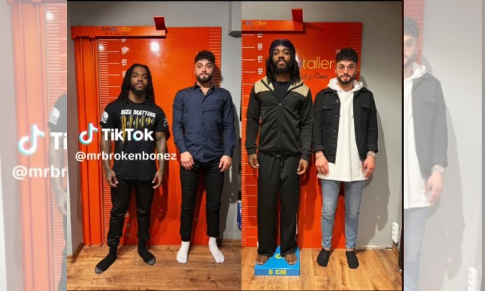 VÍDEO | Rapper faz tratamento polêmico e cresce 17 centímetros de altura